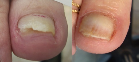 Podiatry Blog for Caruso Foot & Ankle - Posts and Articles for Foot Health