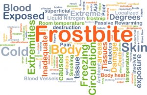 Frostbite symptoms, prevention and treatment | Caruso Foot & Ankle